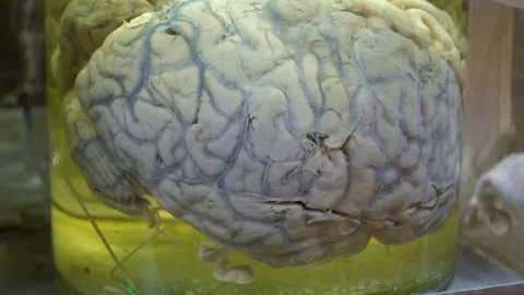 Real human brain, grey matter. Human bra... | Stock Video | Pond5