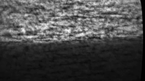 Real-life static noise practical composi... | Stock Video | Pond5