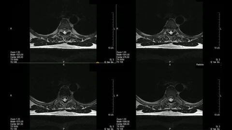 Real MRI Scan of Doctor examining the th... | Stock Video | Pond5
