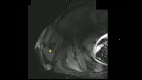 Real MRI Scan of Doctor examining male s... | Stock Video | Pond5