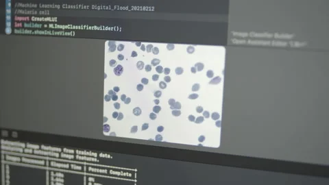 Cell Machine Stock Videos – Royalty-Free HD & 4K Videos