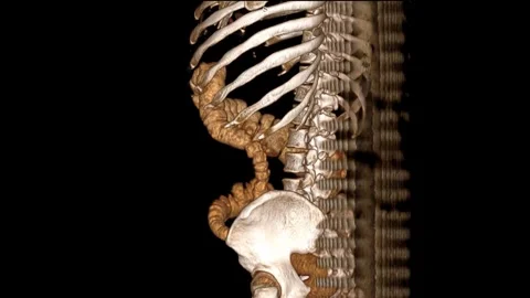 Realistic 3D CT Scan of Male Torso Bones... | Stock Video | Pond5