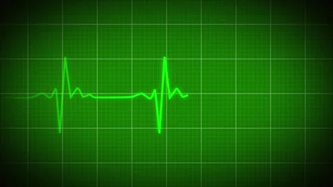 Realistic heart rate monitor animation | Stock Video | Pond5