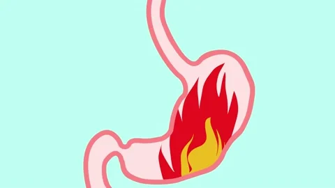 Pyrosis Stock Videos – Royalty-Free HD & 4K Videos | Pond5