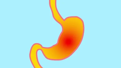 Pyrosis Stock Footage ~ Royalty Free Stock Videos | Pond5