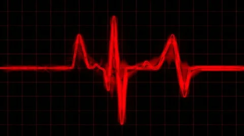 Heart Monitor Stock Footage ~ Royalty Free Stock Videos | Pond5
