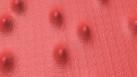 Red pimples and bumps. Skin texture with... | Stock Video | Pond5