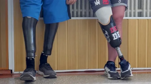 People S Amputee Limb Stock Footage ~ Royalty Free Stock Videos | Pond5