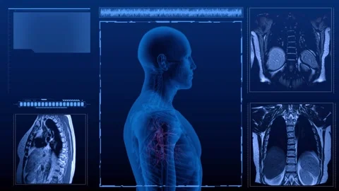 Respiratory bronchial tree MRI multi | Stock Video | Pond5