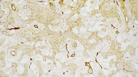 Reticular Tissue Lymph Node Lymph Node Reticular Fibres By Science