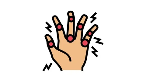Rheumatoid Arthritis Stock Videos – Royalty-Free HD & 4K Videos | Pond5