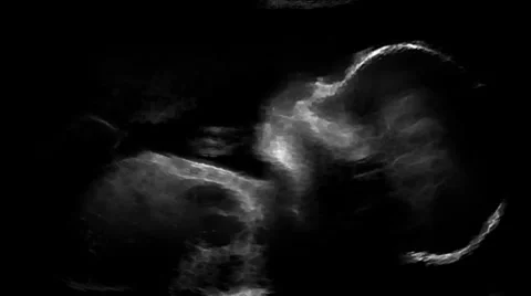 Preborn Stock Video Footage | Royalty Free Preborn Videos | Pond5