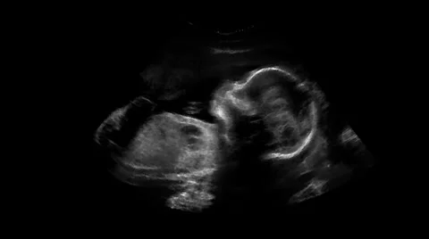 Pregnant Stock Video Footage | Royalty Free Pregnant Videos | Page 2