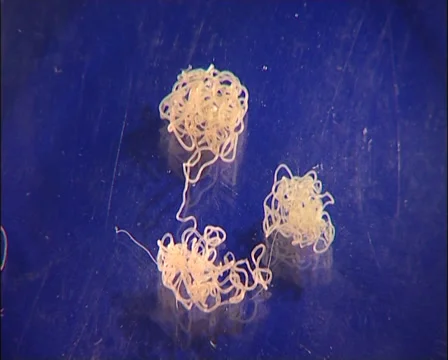 Neglected Tropical Diseases Stock Video Footage | Royalty Free ...