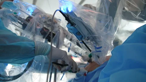 Robotic machine arms during surgery. Doc... | Stock Video | Pond5