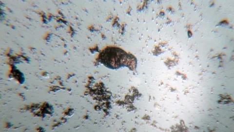 Rotaria rotifers seen under a microscope... | Stock Video | Pond5