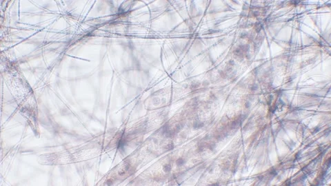 rotifer and cyanobacteria under the micr... | Stock Video | Pond5