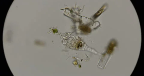 rotifer is kind of like a genus of Collo... | Stock Video | Pond5