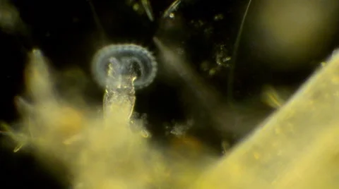Rotifer Stock Video Footage | Royalty Free Rotifer Videos | Pond5