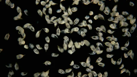 Rotifera Keratella Cochlearis under the ... | Stock Video | Pond5