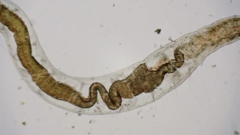 Ground Worm Under Microscope