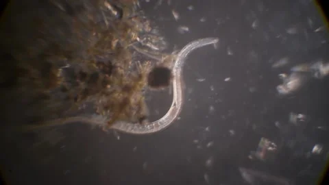 roundworms, Nemathelminthes, eelworms, ... | Stock Video | Pond5
