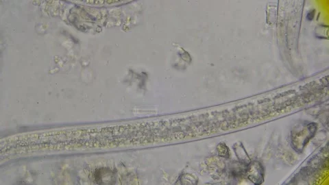 Nematodes Stock Video Footage | Royalty Free Nematodes Videos | Pond5