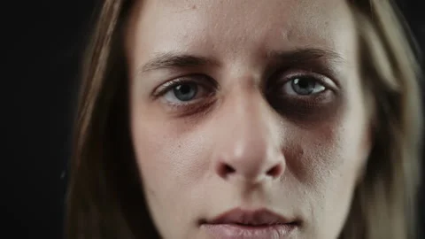 A sad beaten up woman with wounds on fac... | Stock Video | Pond5