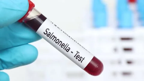 Salmonella test, blood sample to analyze... | Stock Video | Pond5