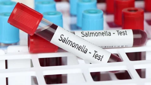 Salmonella test, blood sample to analyze... | Stock Video | Pond5