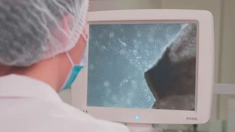 A sample of a substance under a microsco... | Stock Video | Pond5