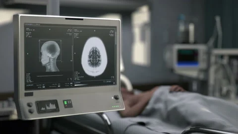 Scanning Brain In Human Skull With Moder... | Stock Video | Pond5