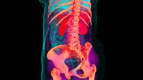 Science Anatomy. Scan Of Human Colon. V... | Stock Video | Pond5