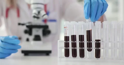 Scientist examines blood samples in mode... | Stock Video | Pond5