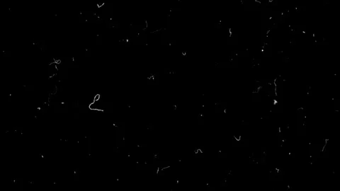 Scratch effect. Vintage TV screen with m... | Stock Video | Pond5