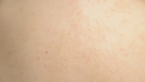 Itchy Stock Video Footage | Royalty Free Itchy Videos | Page 2