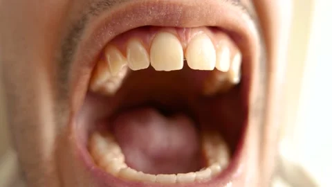 Screaming Mouth Closeup Macro Shot | Stock Video | Pond5