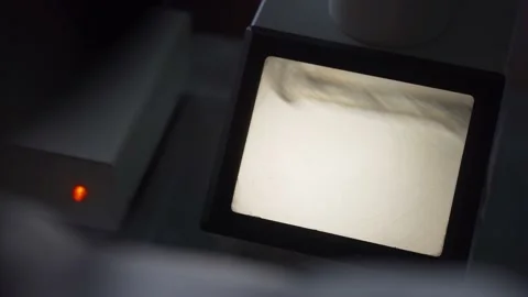 The screen of the microscope. Meat under... | Stock Video | Pond5