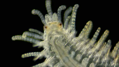 Ciliary Stock Videos – Royalty-Free HD & 4K Videos