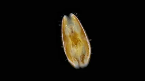 Sea ostracoda under a microscope, Oligos... | Stock Video | Pond5