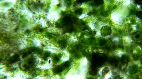 seaweed (alga) under microscope | Stock Video | Pond5