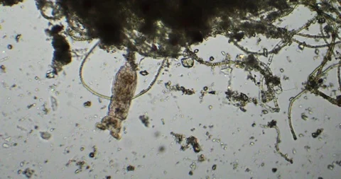 Secret life of microorganisms under micr... | Stock Video | Pond5