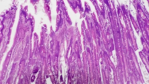 Section of human jejunum filmed under sc... | Stock Video | Pond5