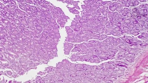 Section of human large intestine magnifi... | Stock Video | Pond5