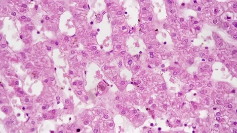 Section of human liver under microscope ... | Stock Video | Pond5