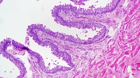 Section of human urethra filmed with 200... | Stock Video | Pond5