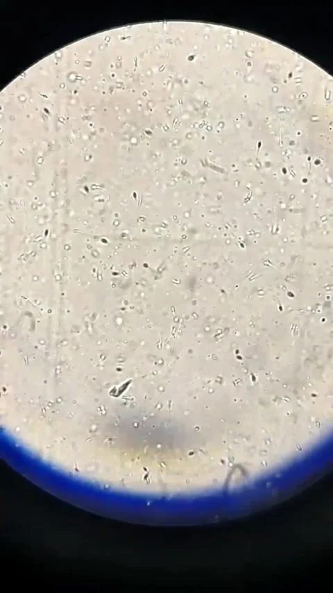 Semen Texture Stock Video Footage | Royalty Free Semen Texture Videos ...