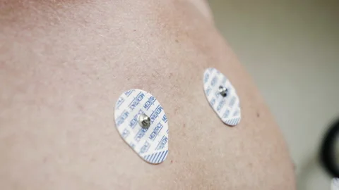 sensors sticker for electrocardiogram (E... | Stock Video | Pond5