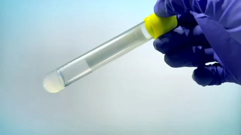 Serum vacuum test tube with clotting act... | Stock Video | Pond5