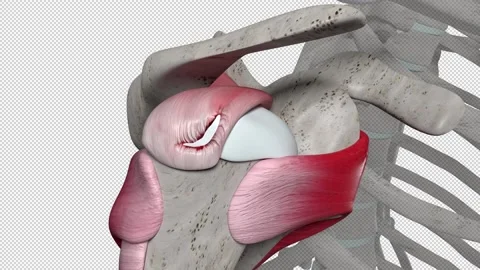 Shoulder Surgery With Corner Stitch Sutu... | Stock Video | Pond5
